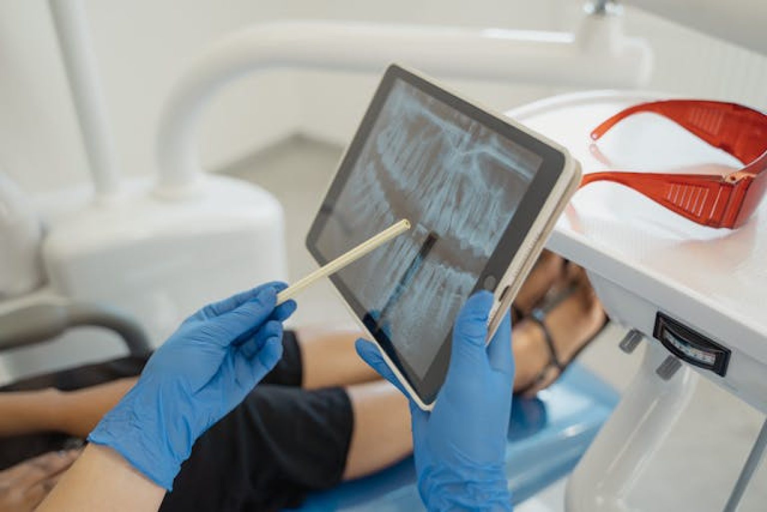 5 Early Warning Signs You May Need A Root Canal And How To Prevent It ...